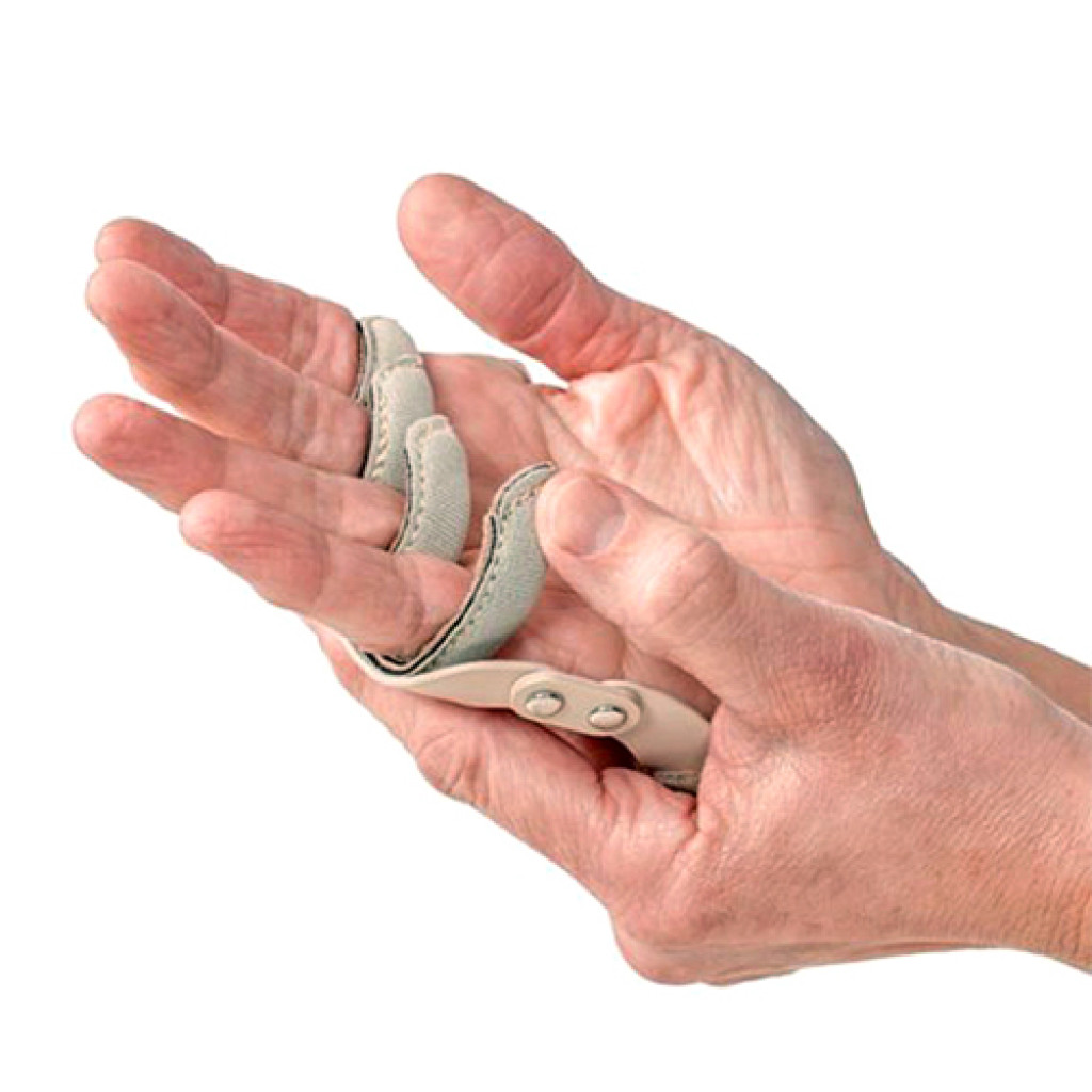 3pp Polycentric Hinged Ulnar Deviation Splint | Access Health